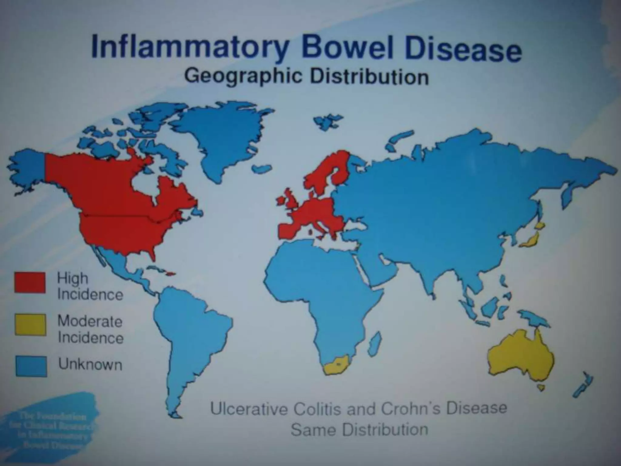 Ulcerative colitis | PPTX