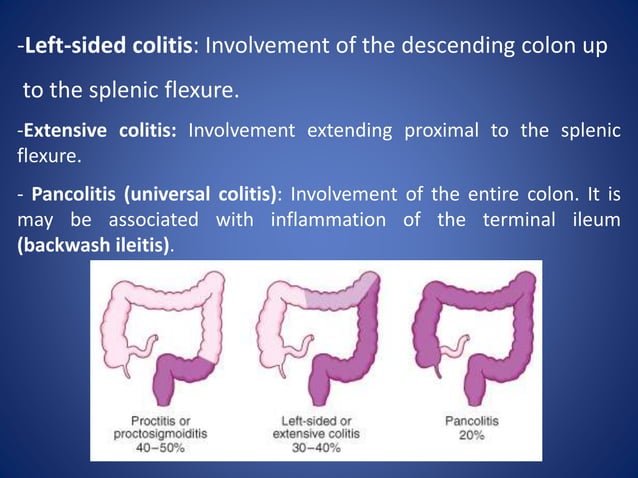 Ulcerative colitis | PPTX | Digestive Disorders | Diseases and Conditions