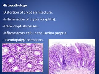 Ulcerative colitis | PPTX