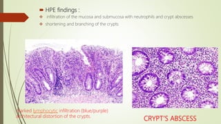 Ulcerative colitis | PPTX