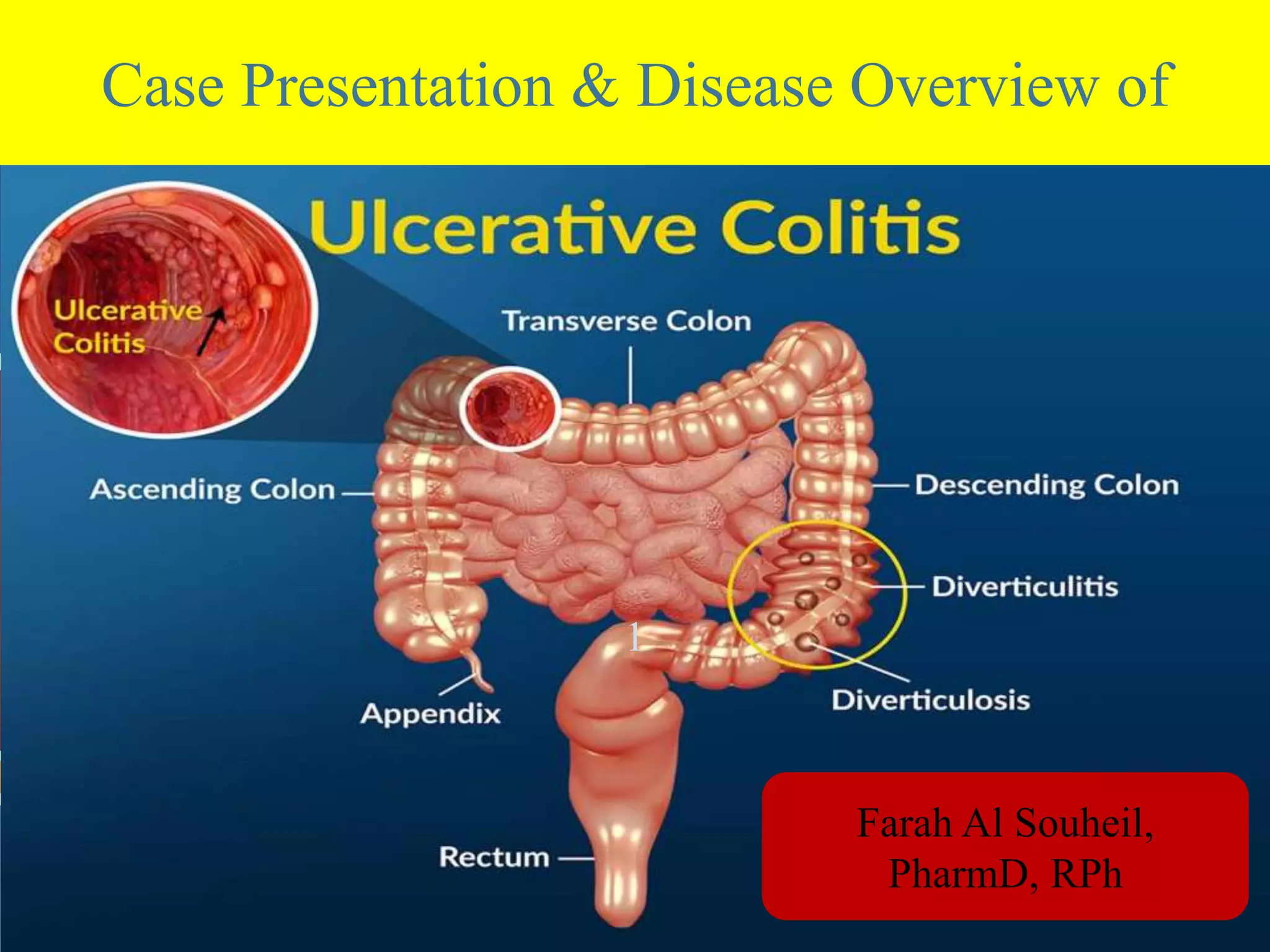 Ulcerative Colitis: Case Presentation & Disease Overview | PPTX