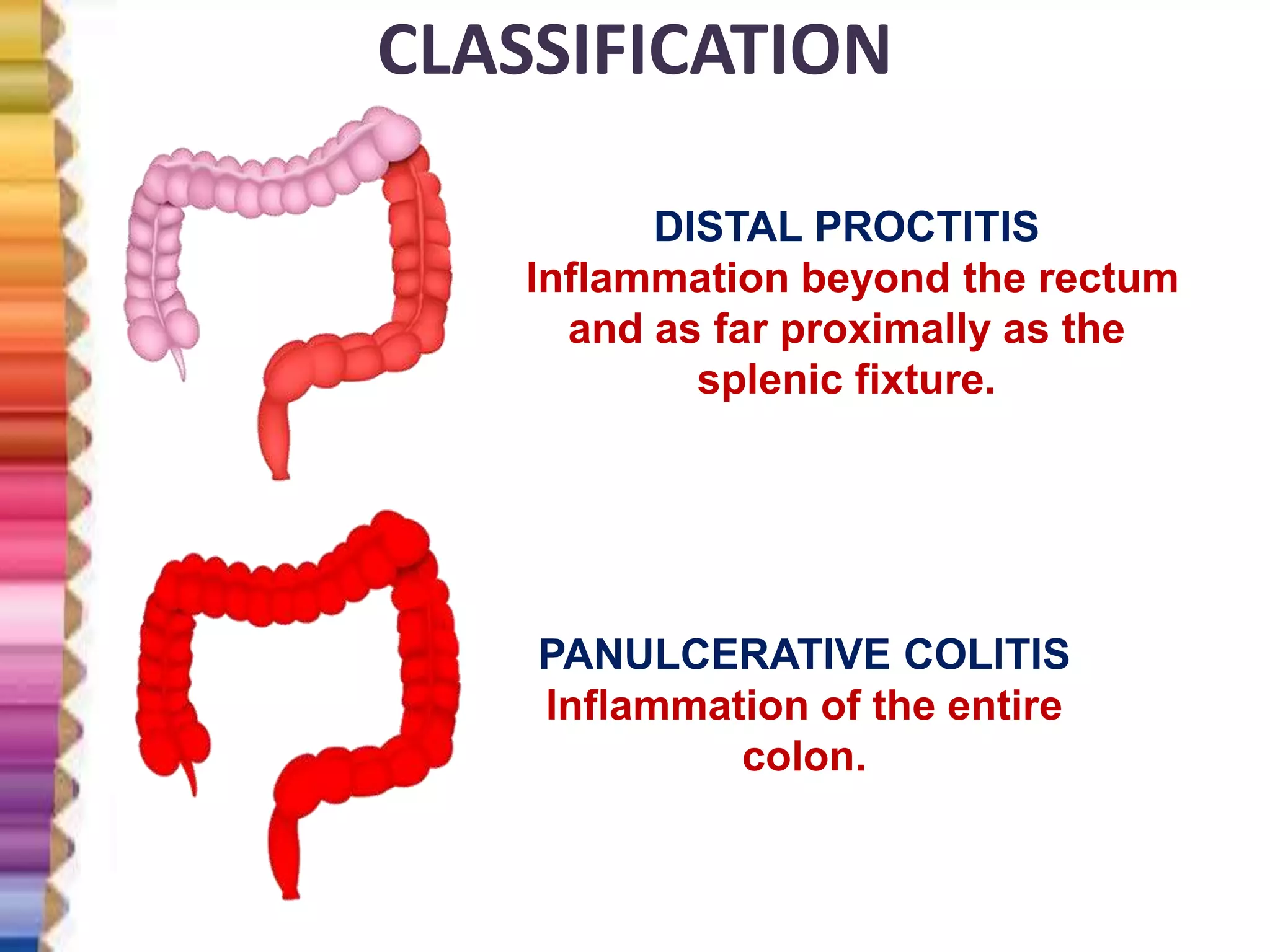 ULCERATIVE COLITIS | PPTX