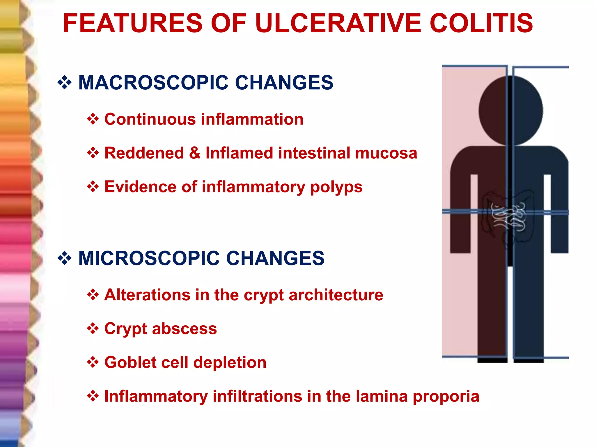 ULCERATIVE COLITIS | PPTX