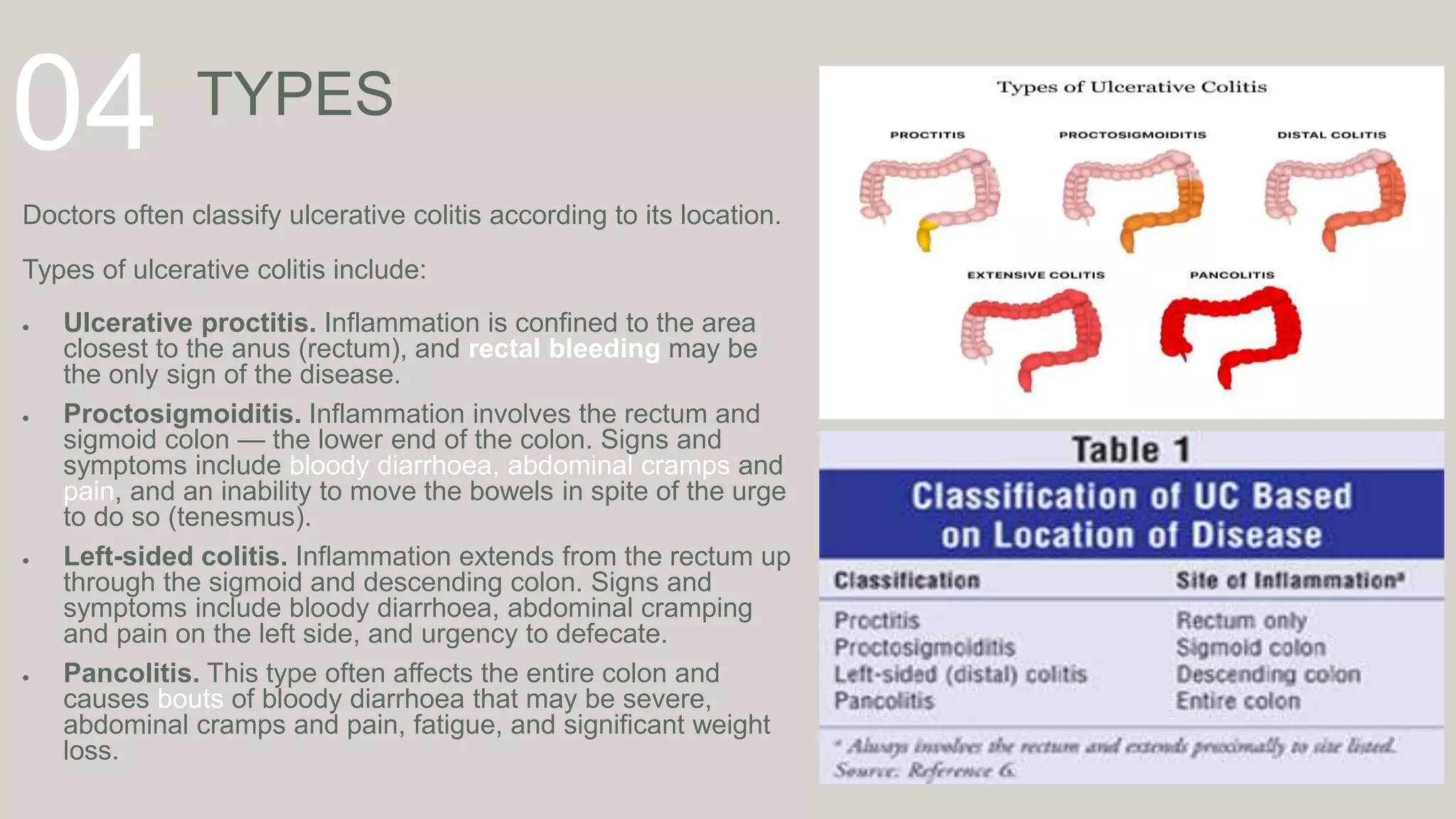 ULCERATIVE COLITIS.pptx