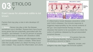 ULCERATIVE COLITIS.pptx