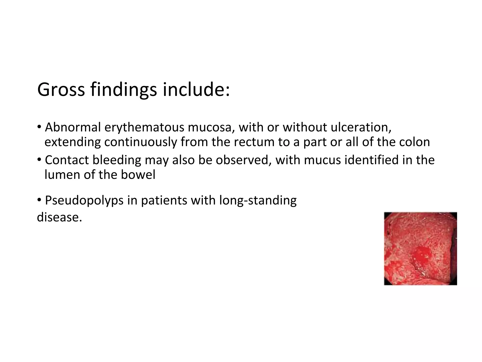 ulcerative colitis.pptx