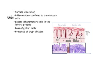 ulcerative colitis.pptx