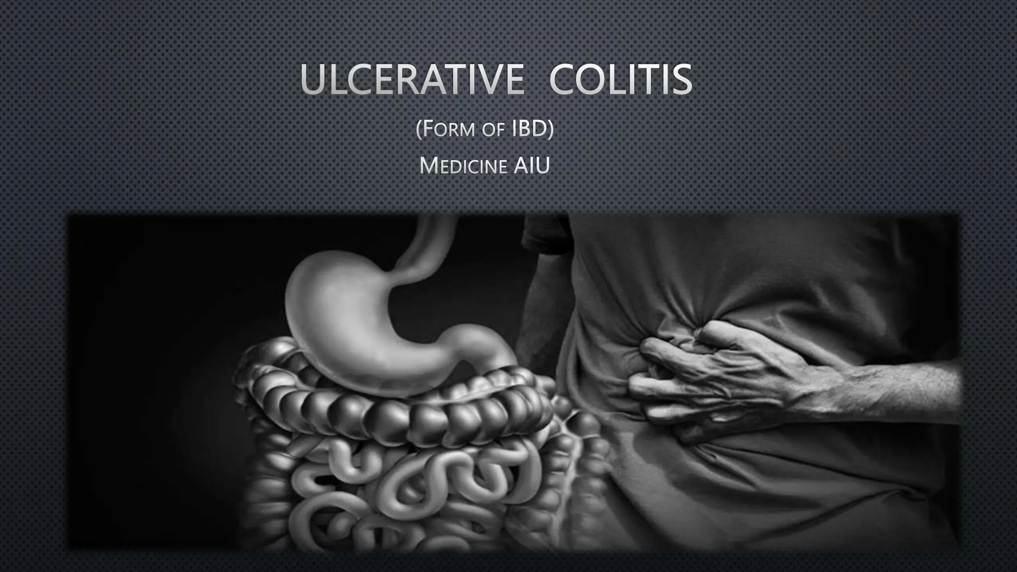 Ulcerative colitis (inflammatory Bowel Disease) | PPT