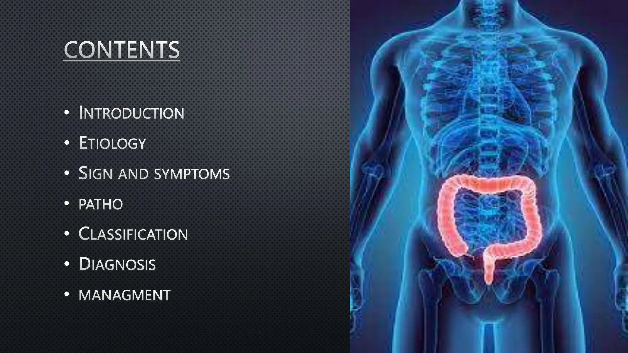 Ulcerative colitis (inflammatory Bowel Disease) | PPT