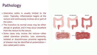 Ulcerative colitis and its ayurvedic corelation | PDF | Digestive ...