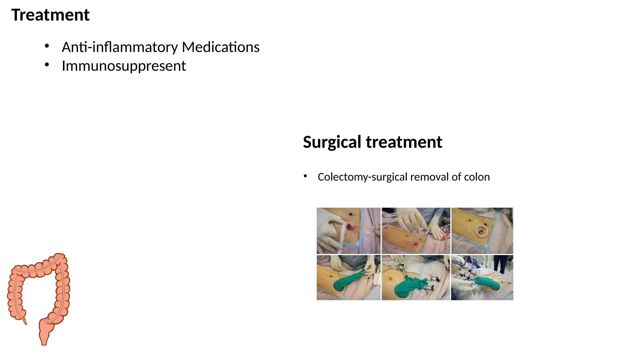 Ulcerative Colitis.It's pathophysiology,symptoms&Management | PPT