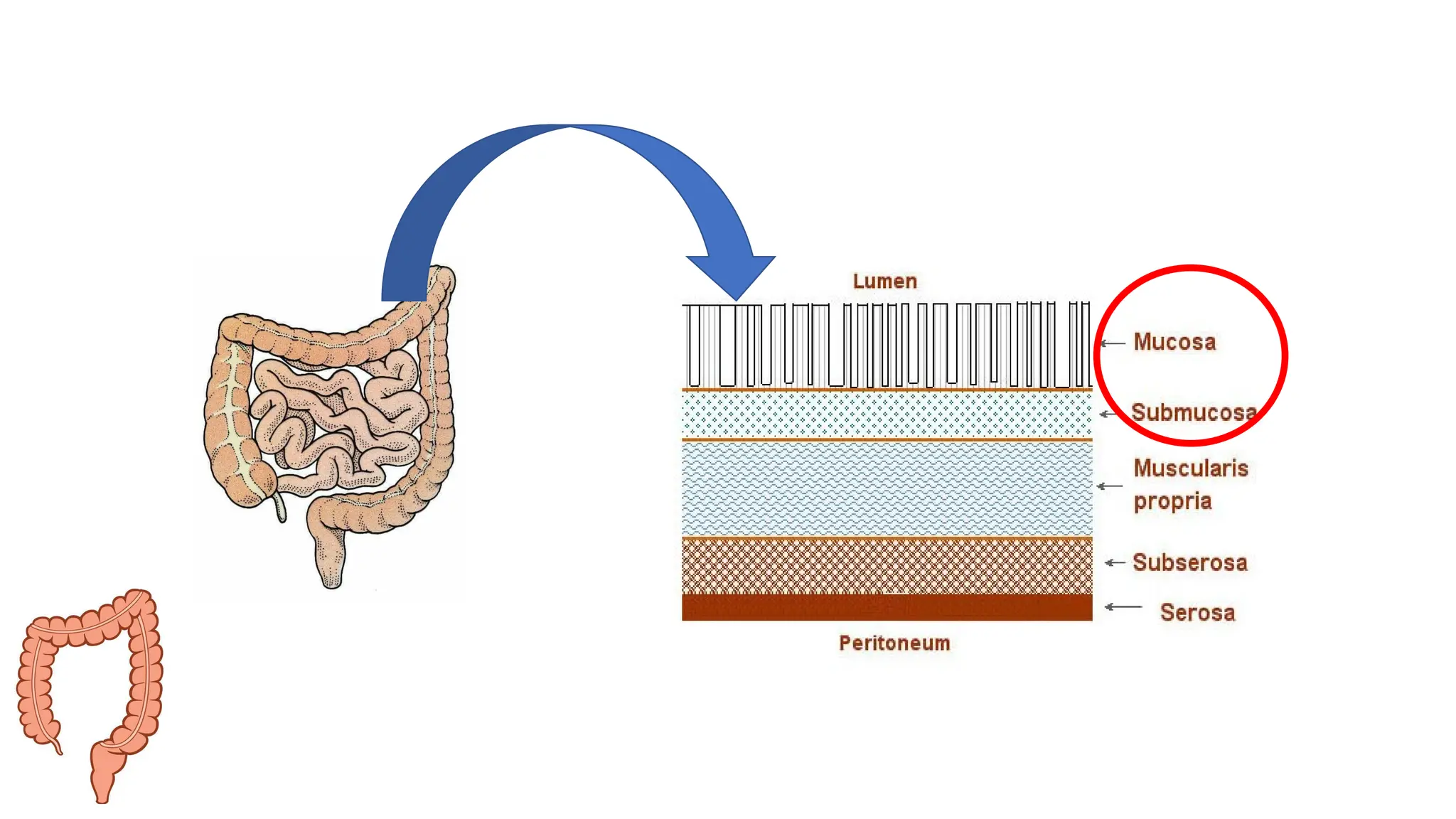 Ulcerative Colitis.It's pathophysiology,symptoms&Management | PPT