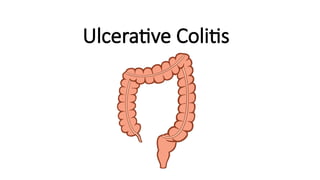 Ulcerative Colitis.It's pathophysiology,symptoms&Management | PPT