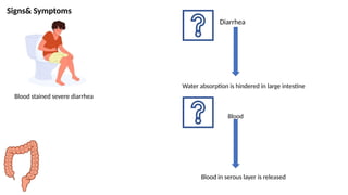 Ulcerative Colitis.It's pathophysiology,symptoms&Management | PPT