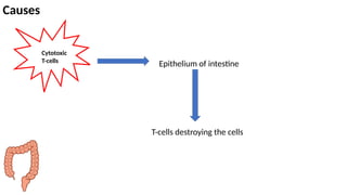 Ulcerative Colitis.It's pathophysiology,symptoms&Management | PPT