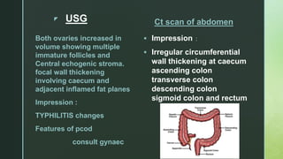 ulcerative colitis case presentation | PPTX
