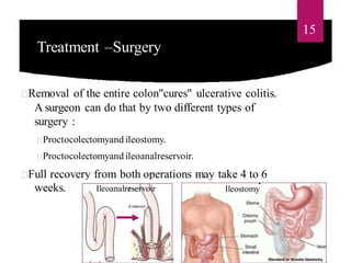 INFLAMMATORY BOWEL DISEASE BY DR. JOSEPH OYEPATA SIMEON | DOCX ...