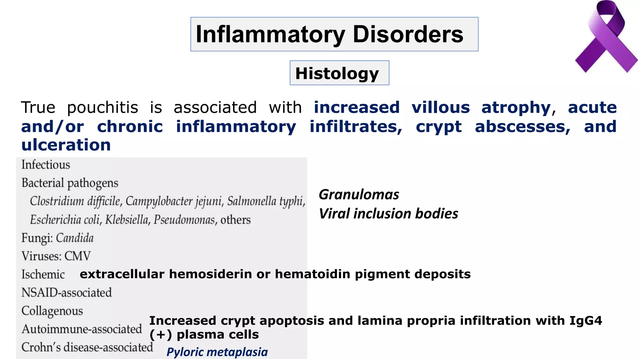 Ulcerative colitis complications management | PPTX