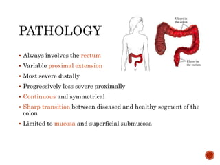 Ulcerative colitis by Dr. Ali Hasan | PPT