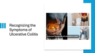 Ulcerative Colitis IBD - Essential Tips.pdf