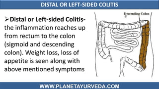 Natural treatment for Ulcerative Colitis | PPT