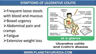 Natural treatment for Ulcerative Colitis | PPTX