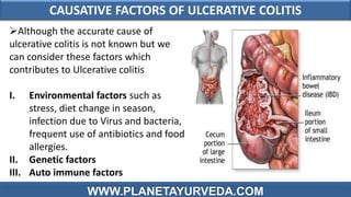 Natural treatment for Ulcerative Colitis | PPT