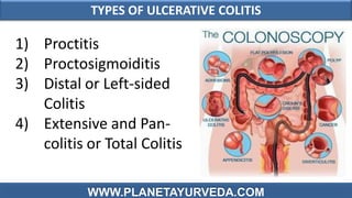 Natural treatment for Ulcerative Colitis | PPT