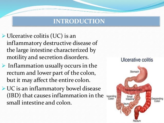 Ulcerative Colitis Seminar Topic Ppt002