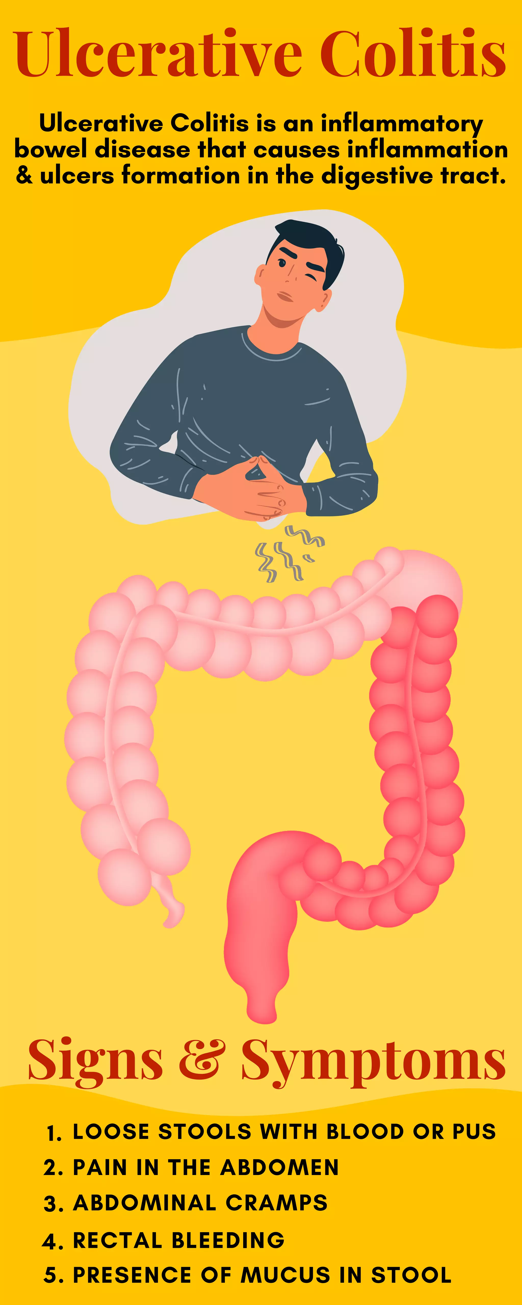 Ulcerative Colitis Signs And Symptomspdf