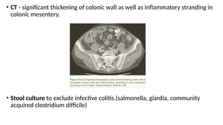 Ulcerative colitis, Toxic megacolon surgical management.pptx