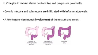 Ulcerative colitis, Toxic megacolon surgical management.pptx
