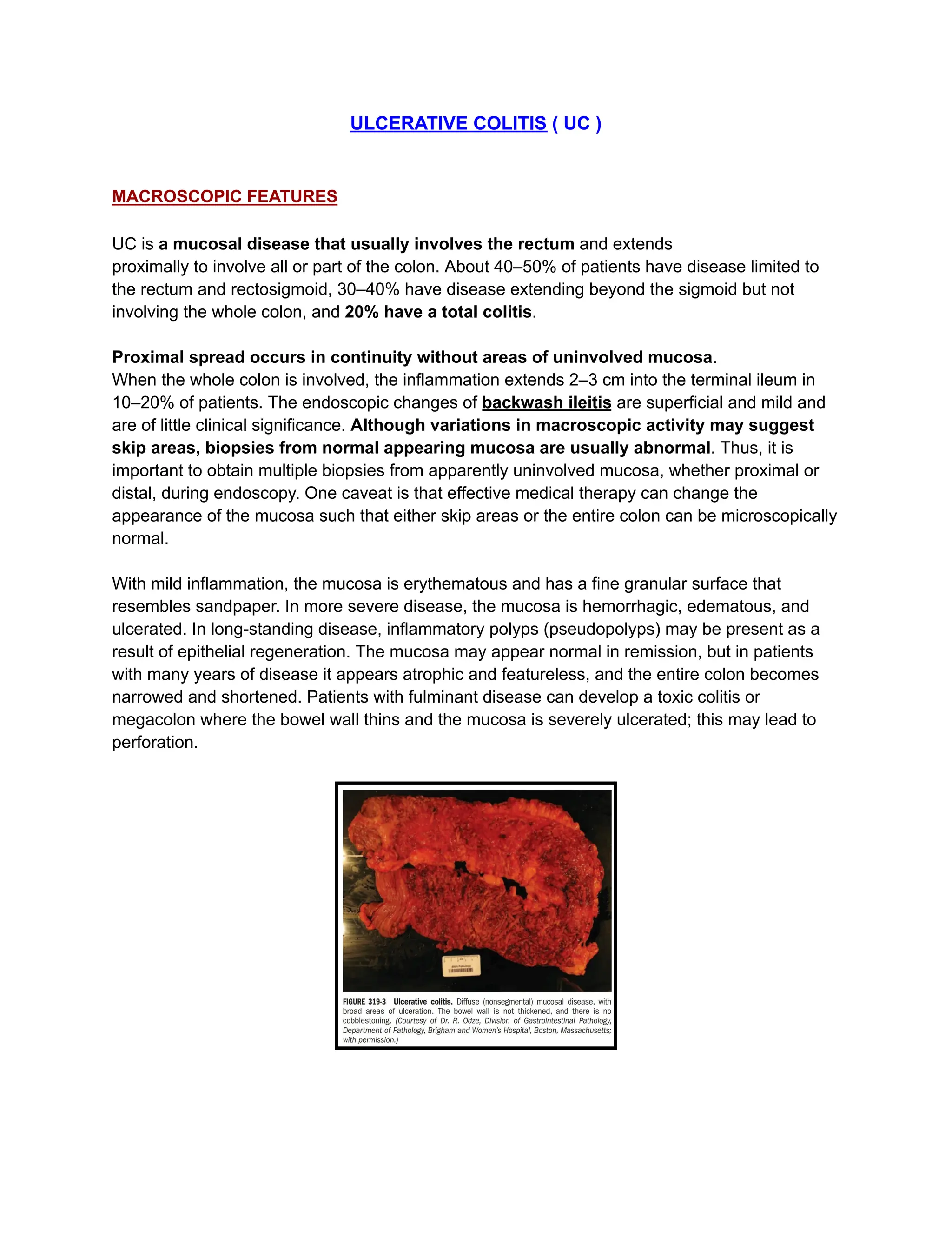 ULCERATIVE COLITIS ( UC ) - Pathology , Clinical Features & Complications.pdf