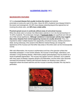 ULCERATIVE COLITIS ( UC ) - Pathology , Clinical Features ...