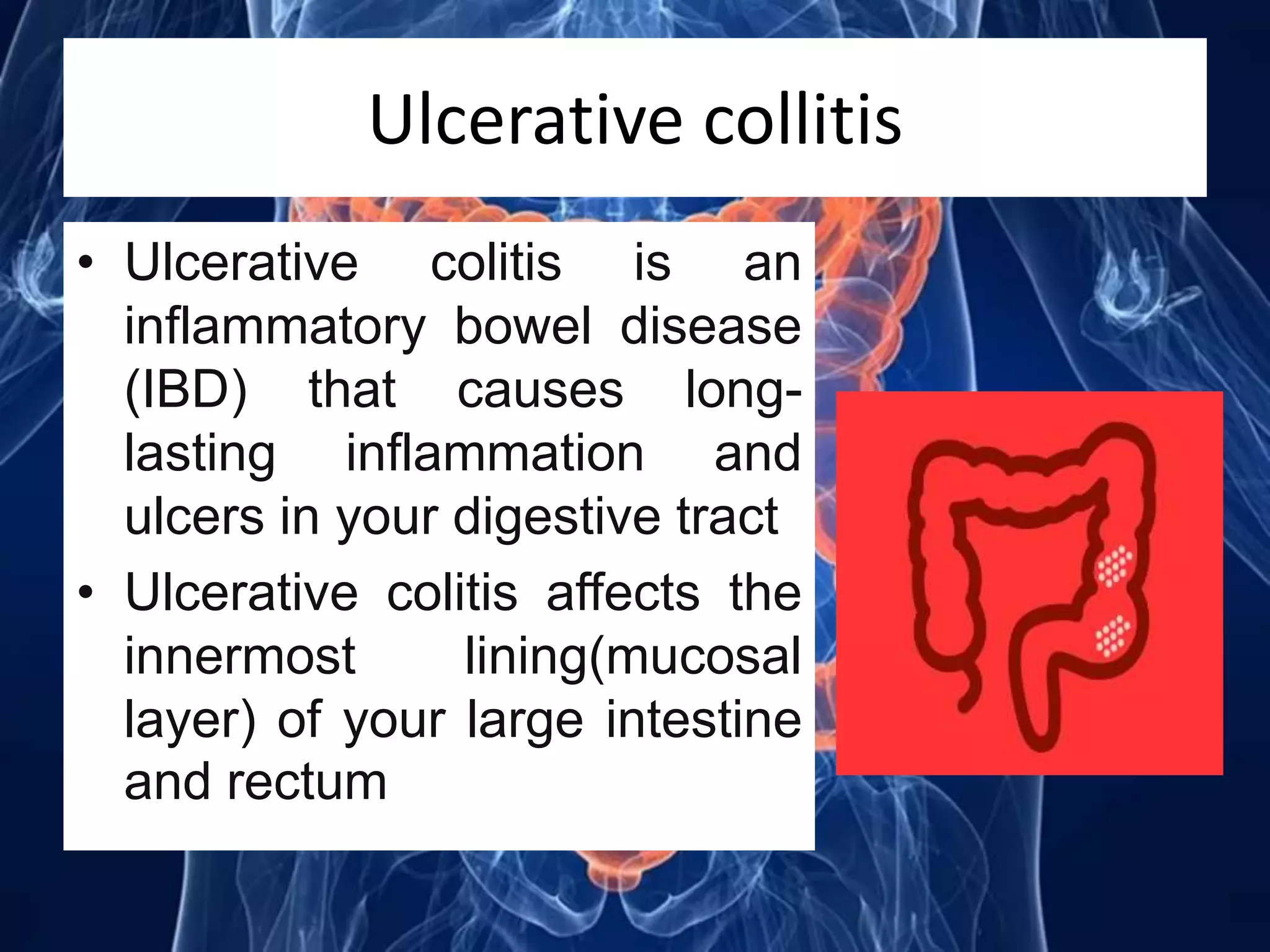 Ulcerative collitis, Nutritional needs and medical nutrition therapy ...