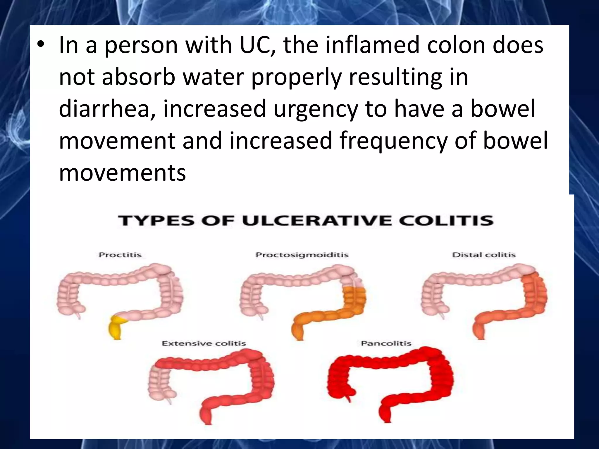 Ulcerative collitis, Nutritional needs and medical nutrition therapy ...