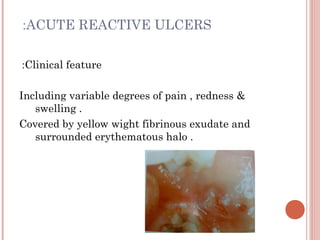 Ulcerative condiion | PPT