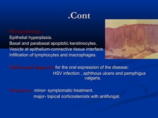 Ulcerative conditions | PPT