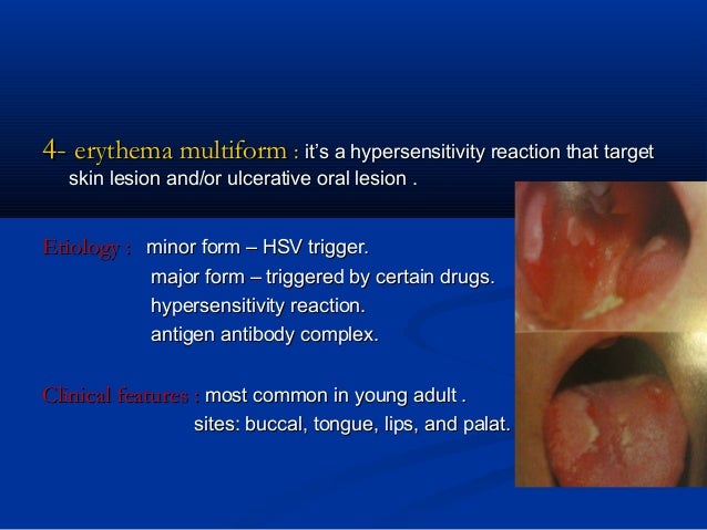 Ulcerative conditions
