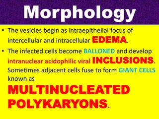 Ulcerative & inflammatory diseases of oral cavity i | PPT