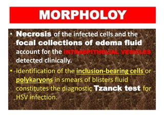 Ulcerative & inflammatory diseases of oral cavity i | PPT