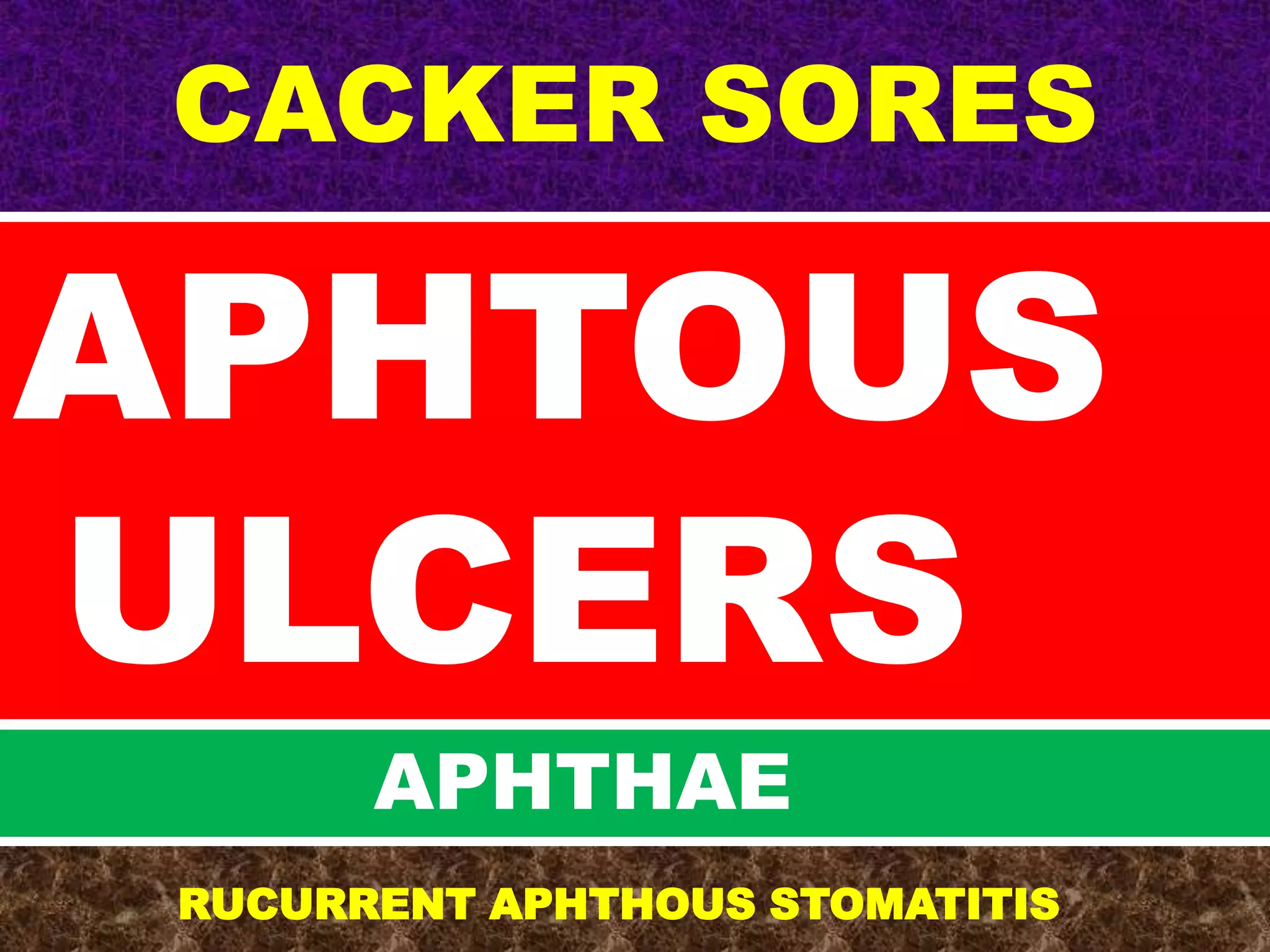 Ulcerative & inflammatory diseases of oral cavity i n | PPTX