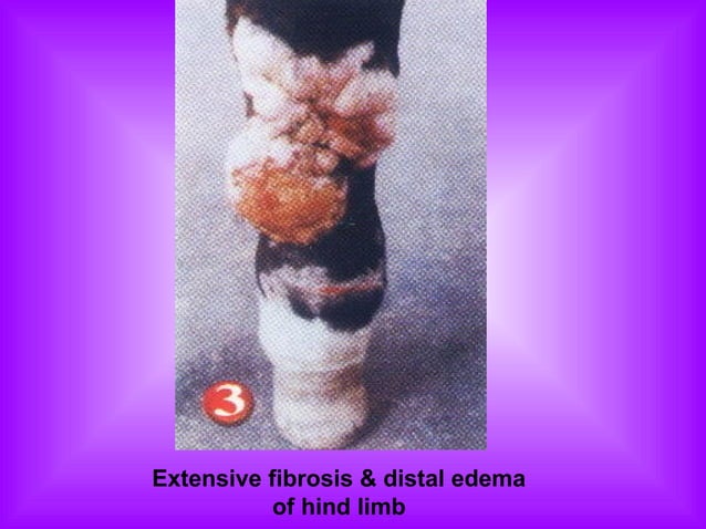 Ulcerative lymphangitis | PPT