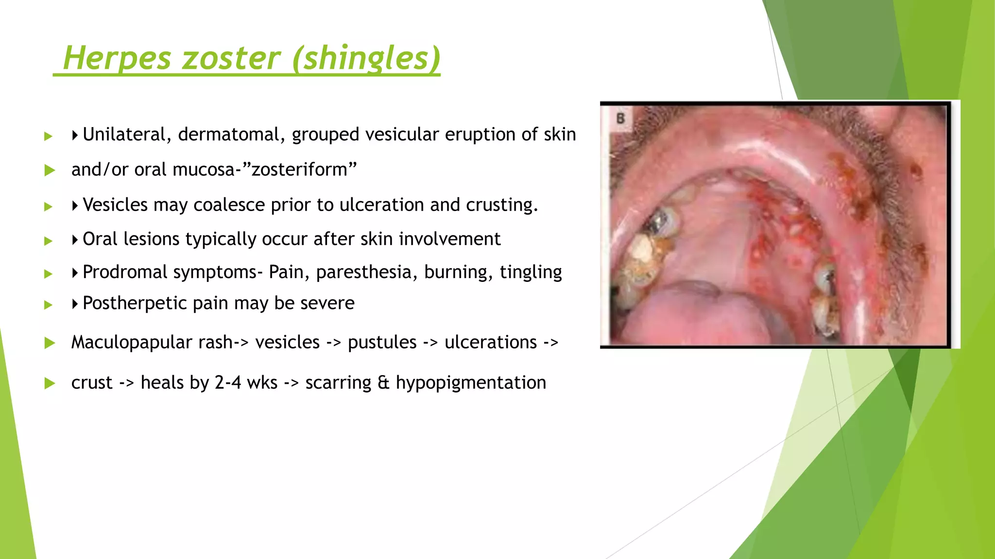 Ulcerative , vascular , bollous lesions | PPTX