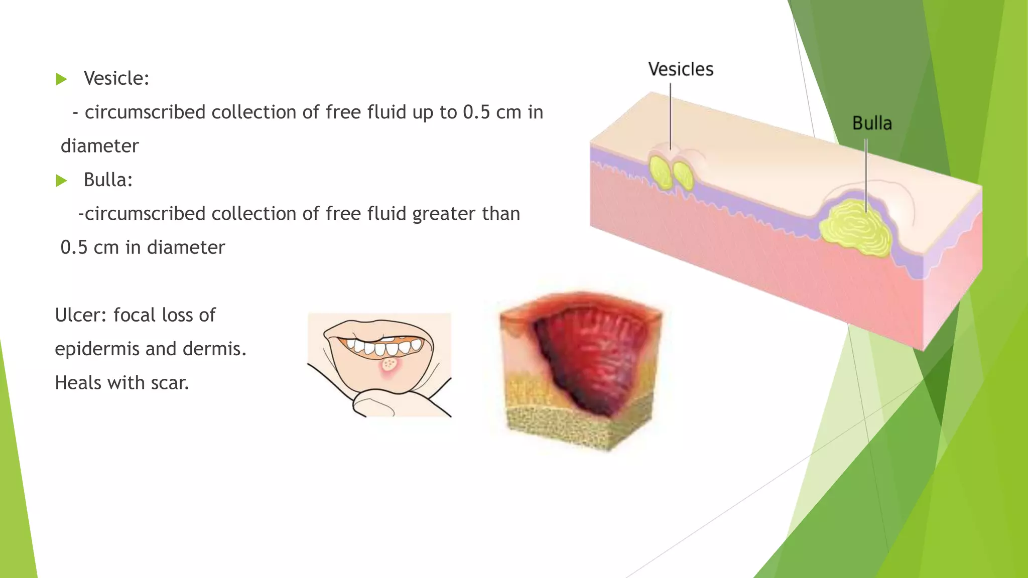 Ulcerative , vascular , bollous lesions | PPTX