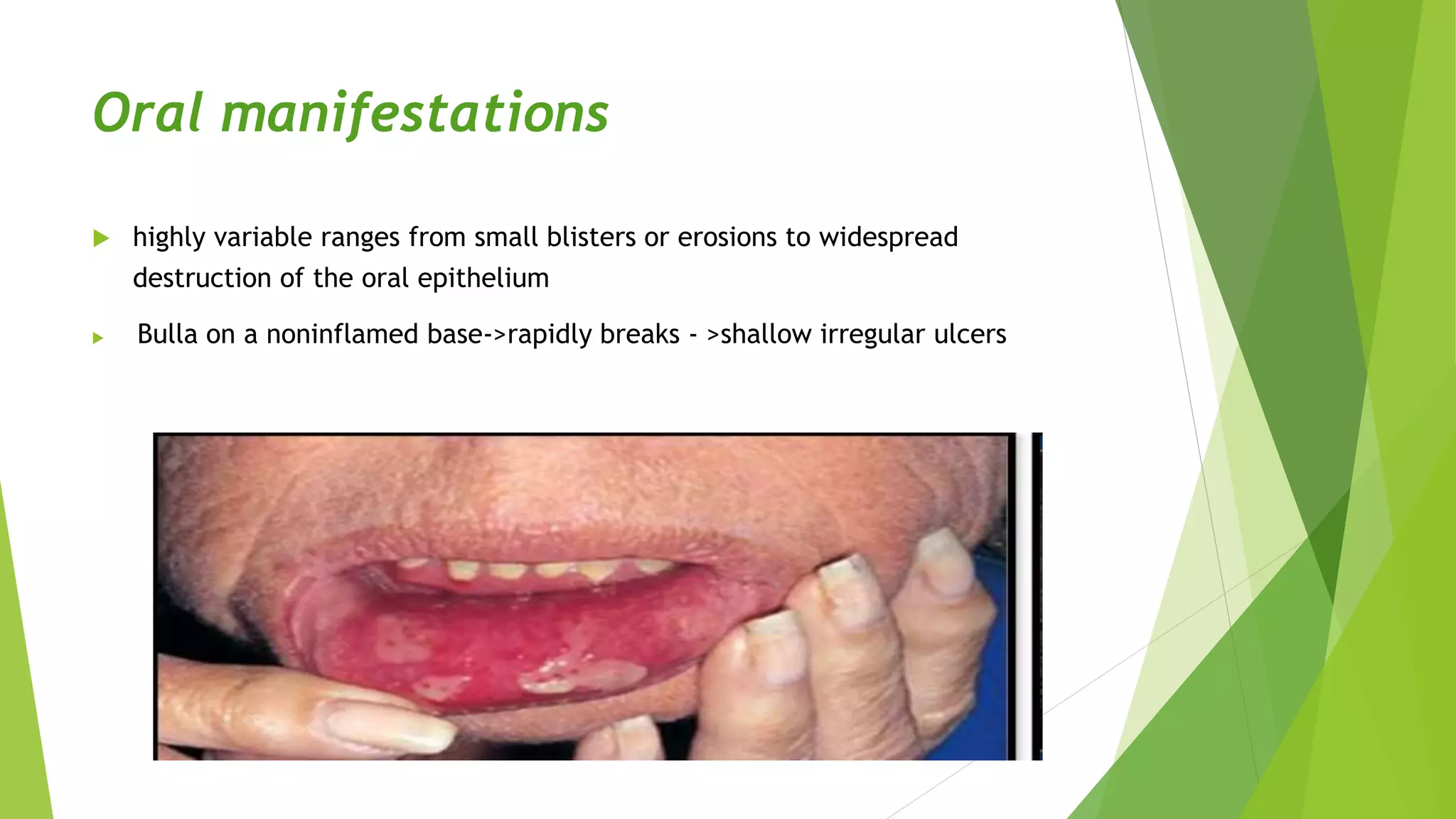 Ulcerative , vascular , bollous lesions | PPTX