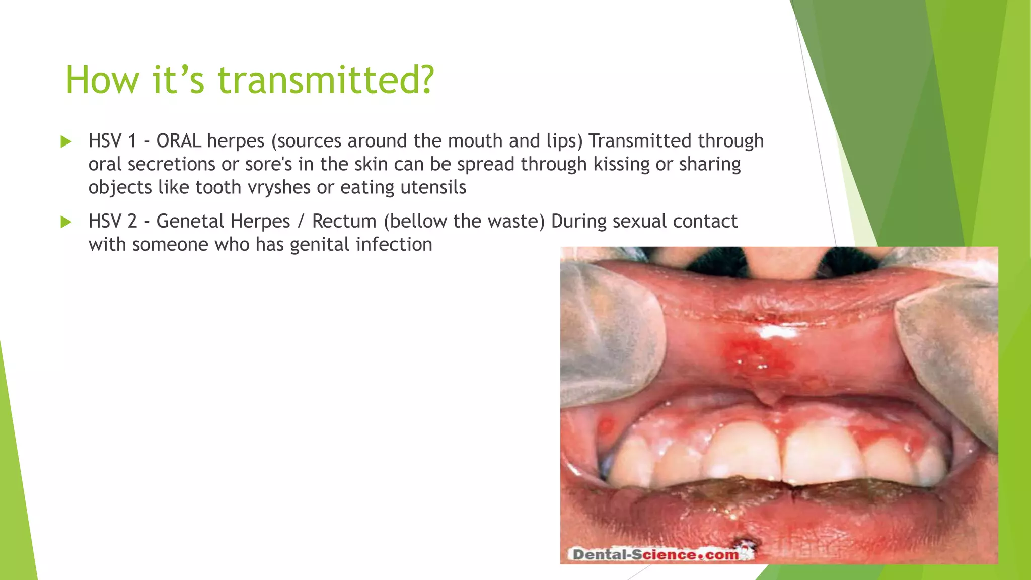 Ulcerative , vascular , bollous lesions | PPTX