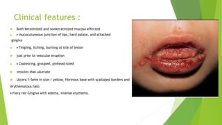 Ulcerative , vascular , bollous lesions | PPTX