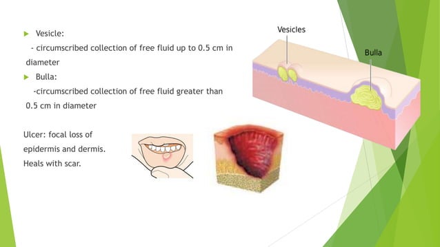 Ulcerative , vascular , bollous lesions | PPTX