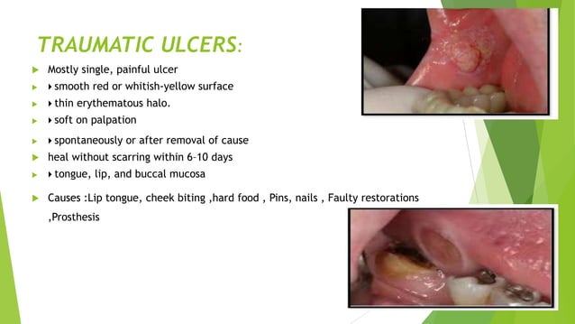 Ulcerative , vascular , bollous lesions | PPTX